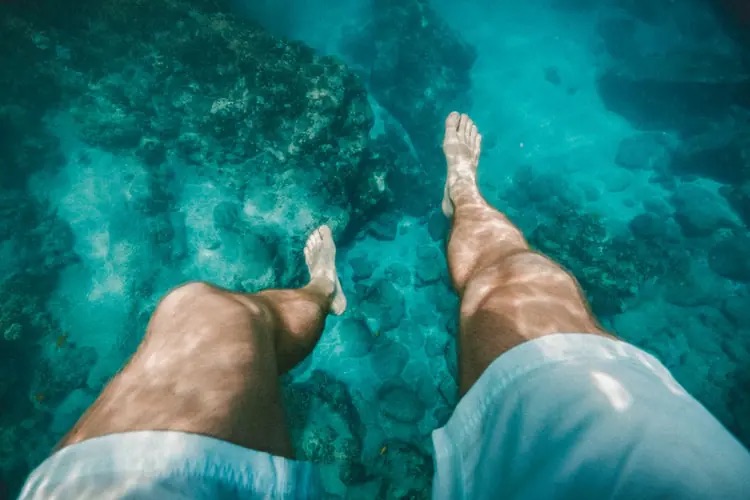 Varicose Veins & Water Retention | What Is Water Retention