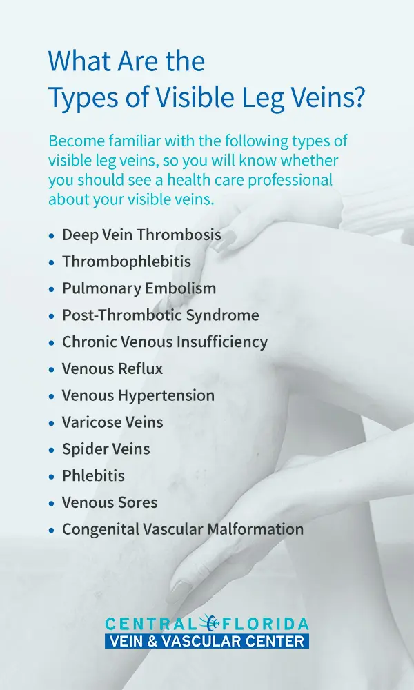 Collapsed Vein